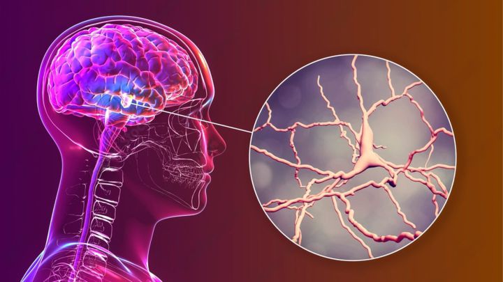 Gain Therapeutics Unveils Star Compounds with Alzheimer’s Cell-Model ...
